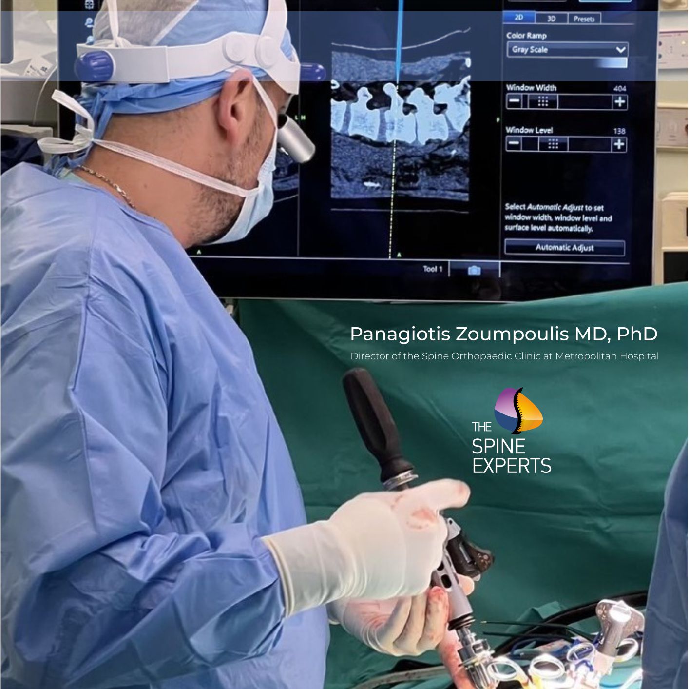 Spine Expert Optical Navigation System – The Spine Experts